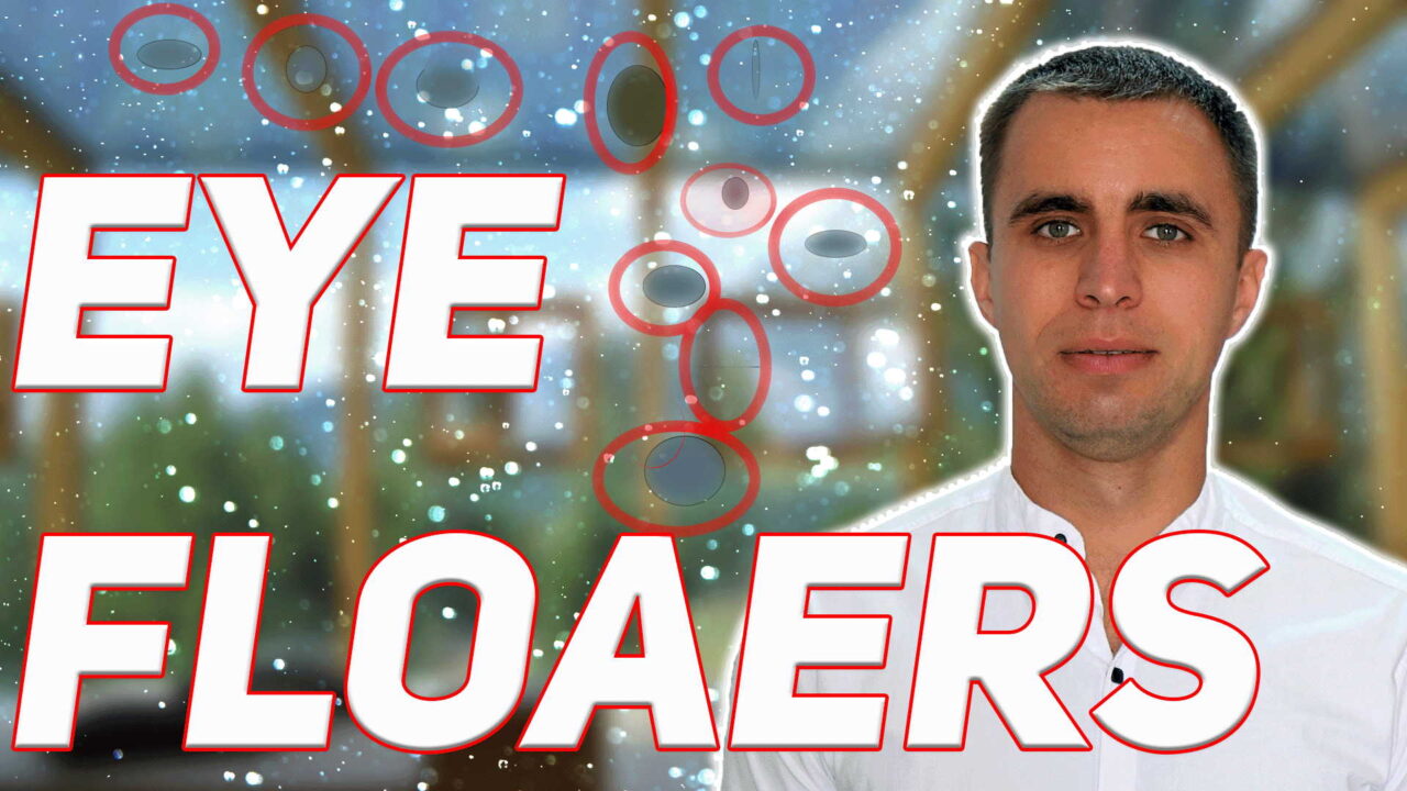 How to reduce eye floaters and flashes Naturally With Eye Exercises ...